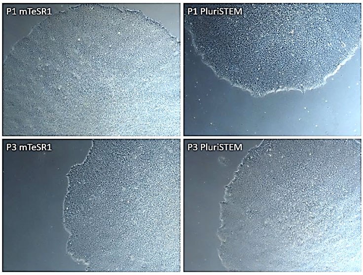 A Serum-Free and Feeder-Free Defined Medium That Enables Weekend-Free ...