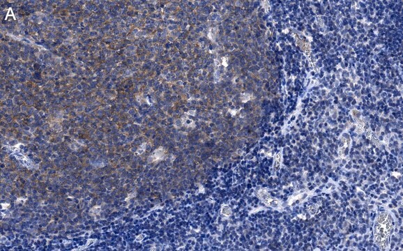 Anti-CD3ζ/CD247 Antibody, clone 1N11 ZooMAb® Rabbit Monoclonal ...