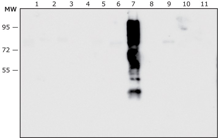 Alcaligenes Faecalis Gram Stain