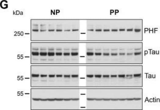 Actin | Sigma-Aldrich