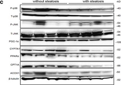Cyp7a1 | Sigma-Aldrich