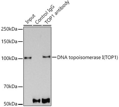 Topoisomerase i | Sigma-Aldrich