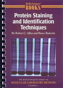Protein Staining and Identification Techniques | Sigma-Aldrich
