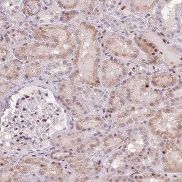 Vantage™ L Laboratory Columns Vantage™ L Laboratory Column VL 11 x 250 ...