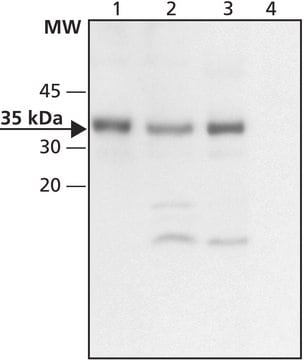 Anti-CHIP (C-terminal) 兔抗 ~1 mg/mL, affinity isolated antibody ...